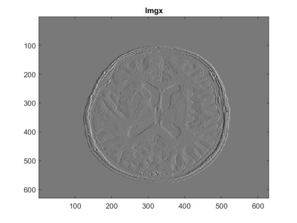 Blog Image Processing Via Fuzzy Logic Toolbox Matlab Helper