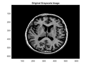 Blog-Image Processing Via Fuzzy Logic Toolbox-MATLAB Helper