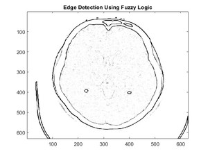 Blog-Image Processing Via Fuzzy Logic Toolbox-MATLAB Helper
