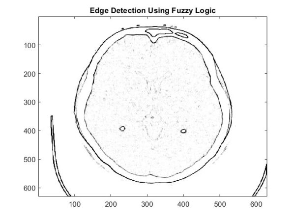 Blog-Image Processing Via Fuzzy Logic Toolbox-MATLAB Helper