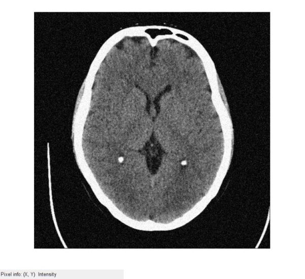 Blog-Image Processing Via Fuzzy Logic Toolbox-MATLAB Helper