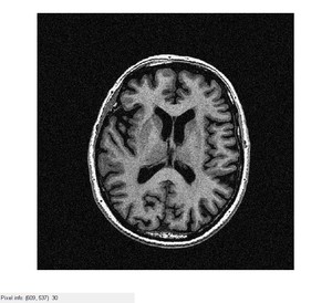 Blog-Image Processing Via Fuzzy Logic Toolbox-MATLAB Helper