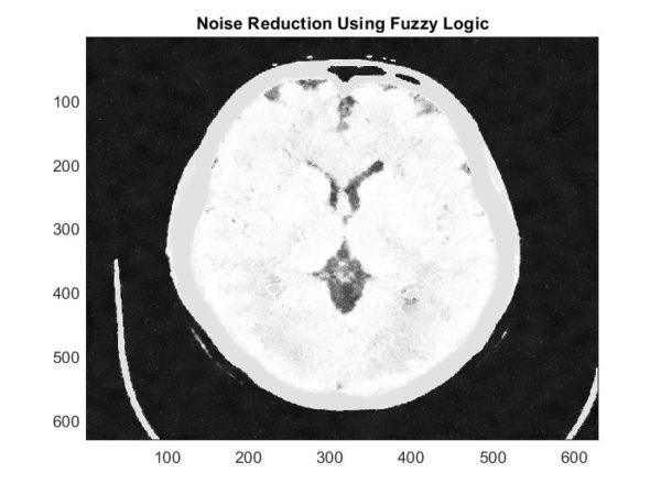 Blog-Image Processing Via Fuzzy Logic Toolbox-MATLAB Helper