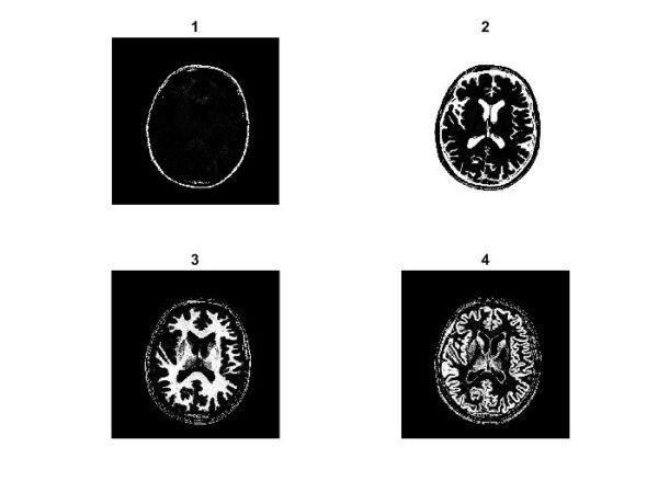 Blog-Image Processing Via Fuzzy Logic Toolbox-MATLAB Helper